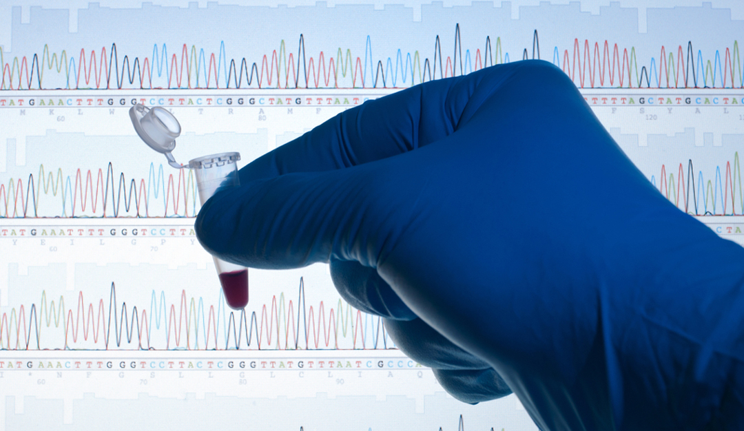 Most Patients With Triple Negative Breast Cancer Would Benefit From ...