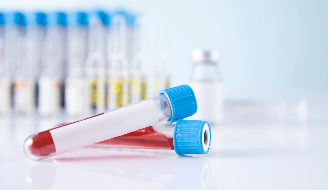 New Liquid Biopsy Technique May Help Personalize Breast Cancer ...